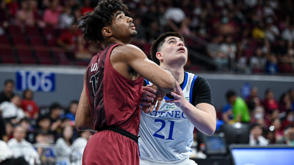 Francis Lopez shrugs off pain, vows UP fightback